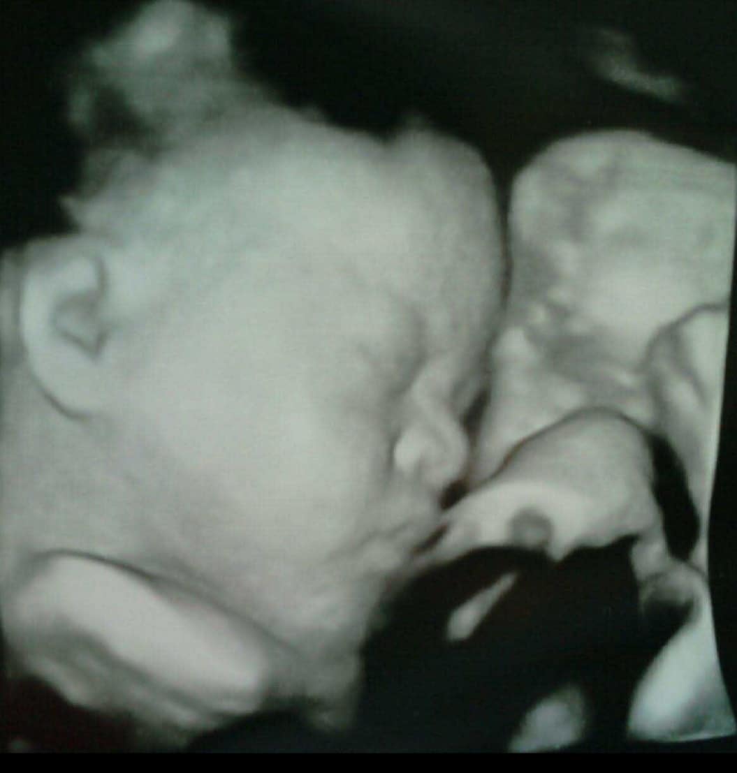 Thumbs up on life for Gambrills family - Catholic Review